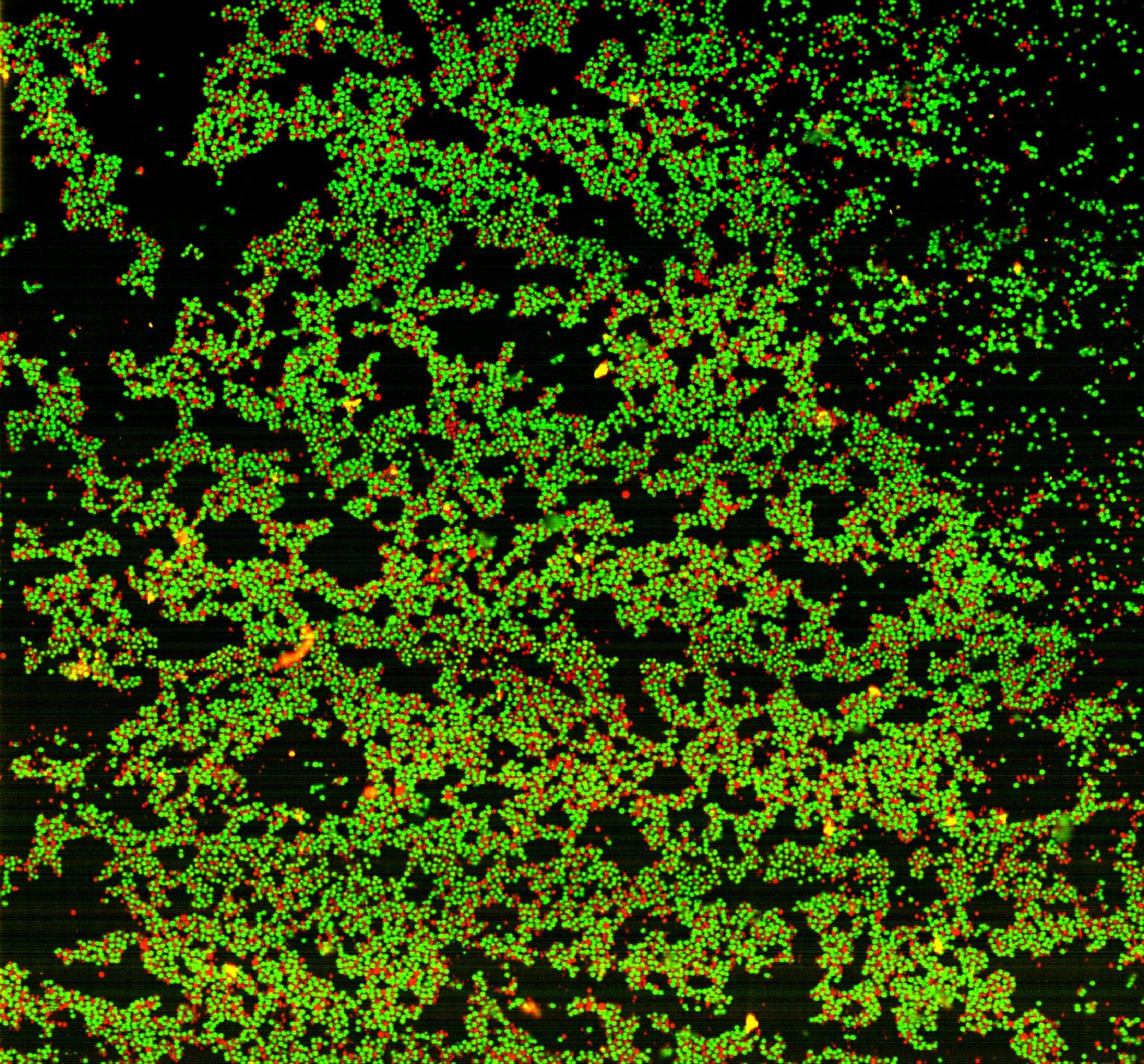 Widefield Distribution Observation of Polystyrene / PMMA Particles ...